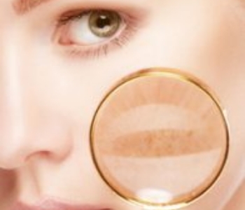 Forma Face Ironing Treatment | AgeLess Clinic