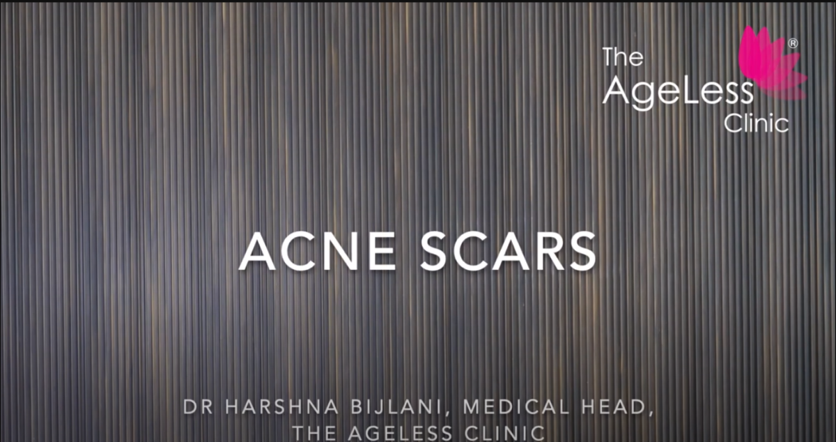Acne Scar & Marks Treatments | AgeLess Clinic